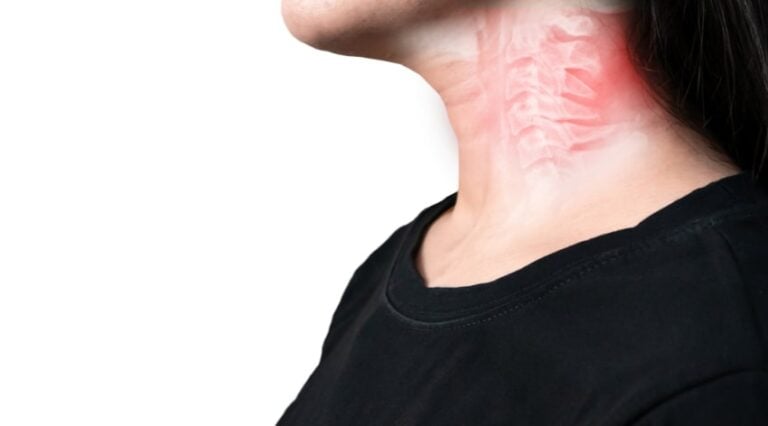 Spondiloza cervicală - simptome și tratament eficient